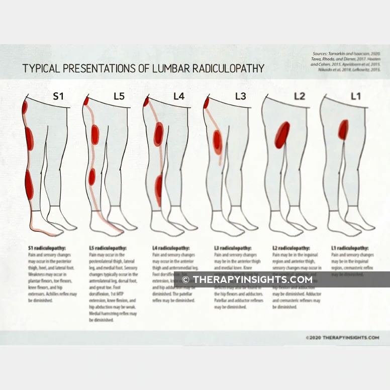 Get Relief From Lower Back Pain From Lumbrosacral 54 OFF